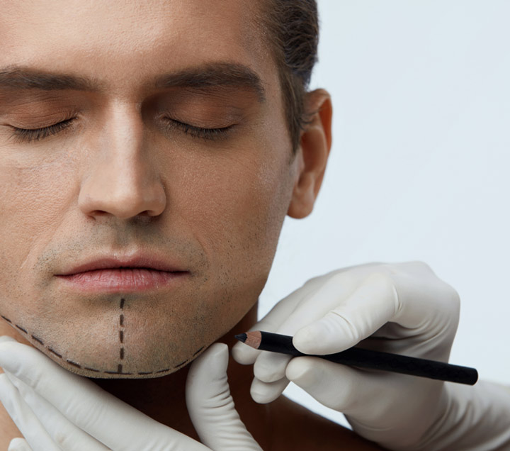 ΓΕΝΕΙΟΠΛΑΣΤΙΚΗ | VF Laser Clinics