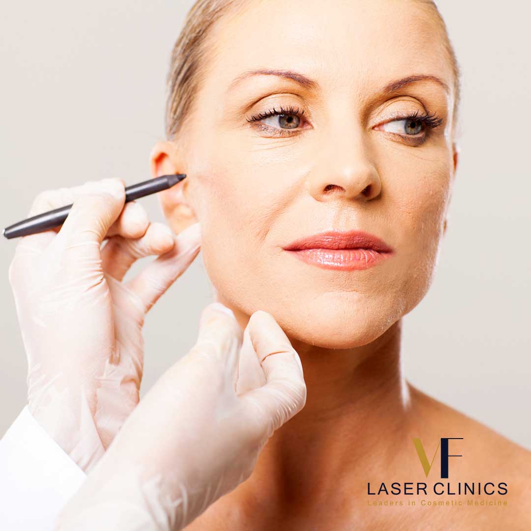 ELIXIRION - ΟΛΙΚΗ ΕΞΑΛΕΙΨΗ ΡΥΤΙΔΩΝ & ΙΣΧΥΡΗ ΛΑΜΨΗ | VF Laser Clinics